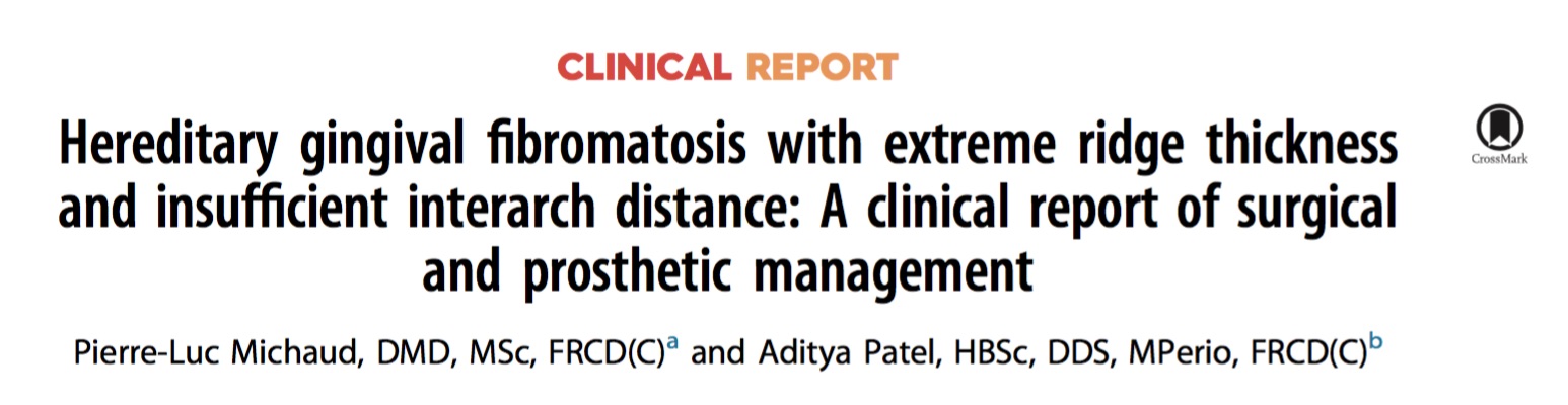治療有Hereditary gingival fibromatosis併有extreme ridge thickness and ...